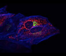 Custom Rabbit Polyclonal Antibody Production Protocols | Thermo Fisher ...