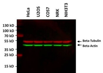 Beta Actin Antibodies | Thermo Fisher Scientific - CN