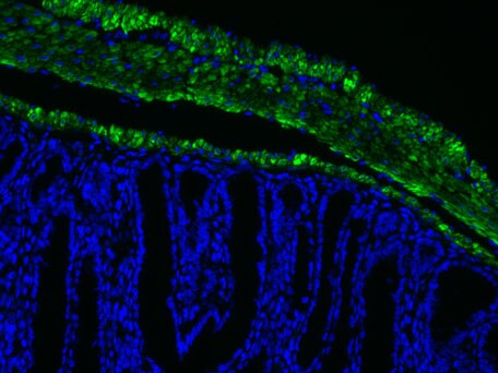 F(ab) and F(ab’)2 Fragment Secondary Antibodies | Thermo Fisher ...