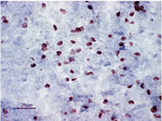 Foxp3 Overview | Thermo Fisher Scientific - CN
