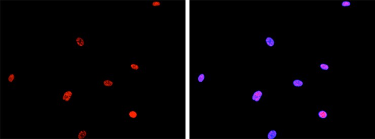 Analysis and Quantitation | Thermo Fisher Scientific - CN