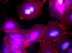 细胞追踪-CellTracker活细胞示踪剂染料-赛默飞 | Thermo Fisher Scientific - CN