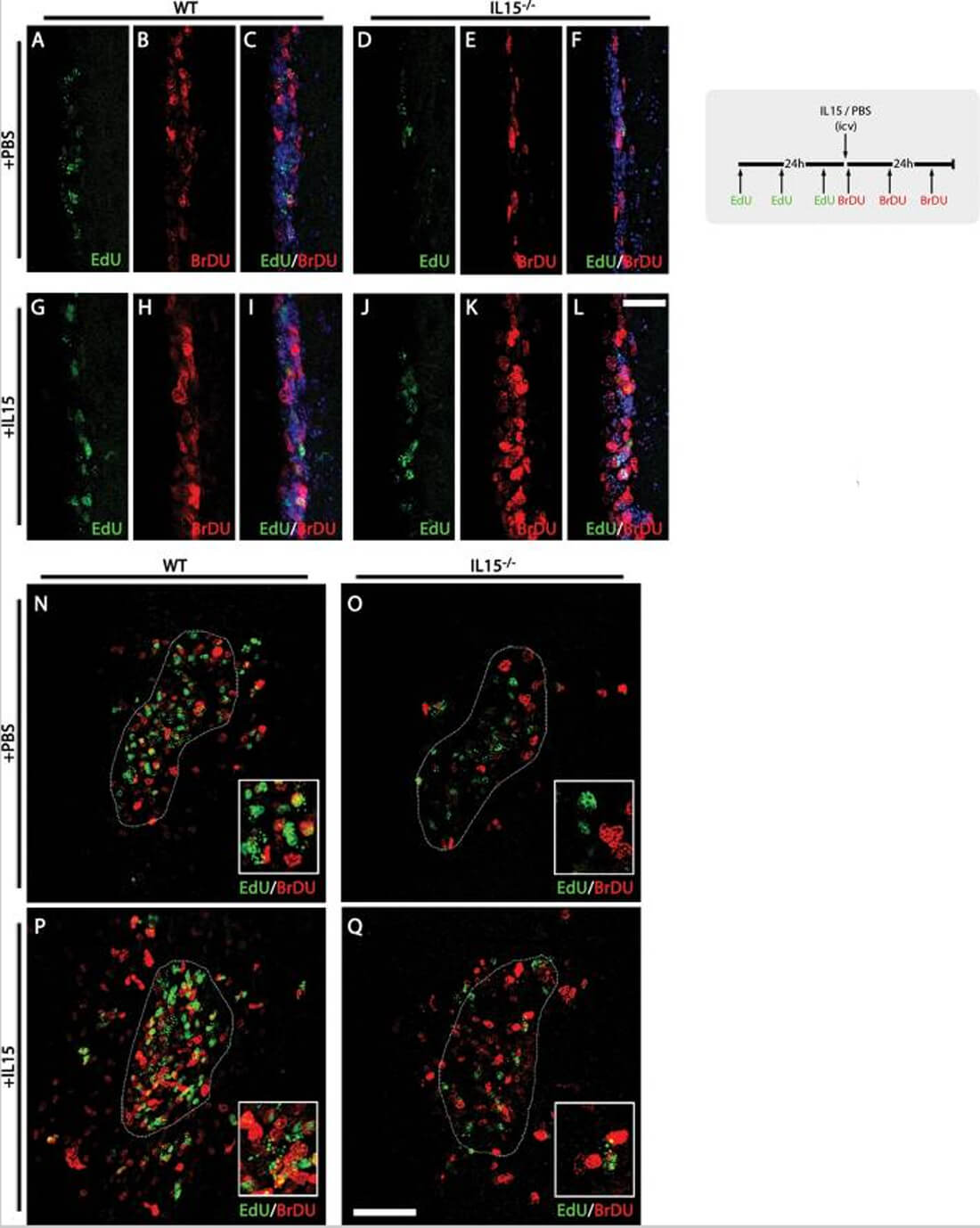 Click-iT EdU 测定法：优于传统 BrdU 测定法 | Thermo Fisher Scientific - CN