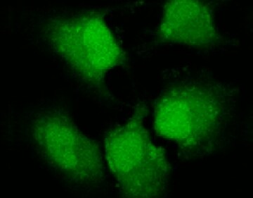 Calcium Indicators | Thermo Fisher Scientific - CN