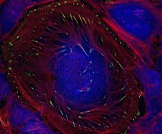 Protein Synthesis Assays | Thermo Fisher Scientific - CN