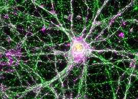 ProLong Gold抗荧光淬灭封片剂-固定细胞-赛默飞 | Thermo Fisher Scientific - CN