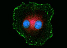 用于活细胞成像的ProLong抗淬灭剂 | Thermo Fisher Scientific - CN