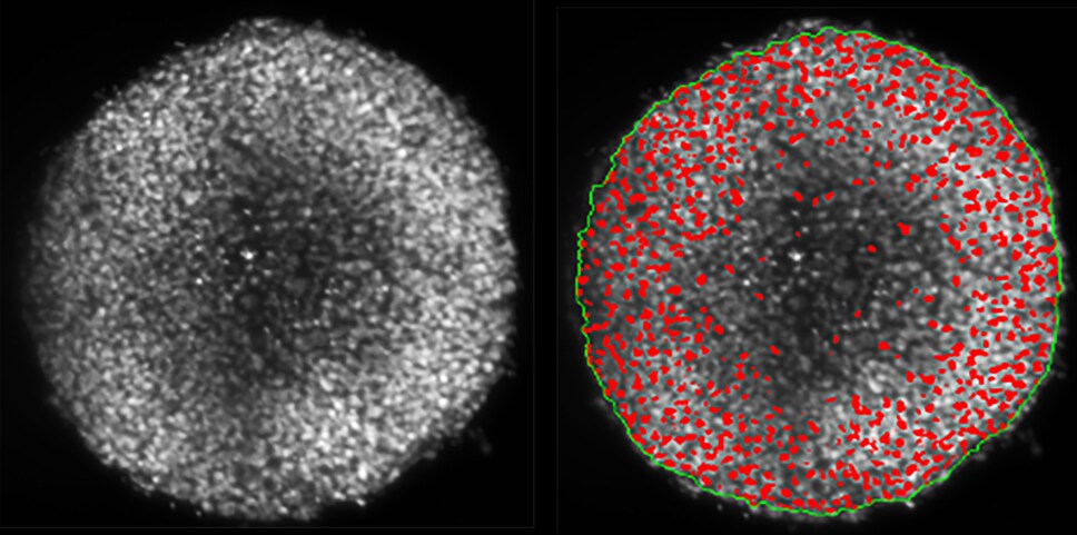 CellInsight CX7 Pro LZR HCS 平台 | Thermo Fisher Scientific - CN