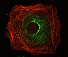 Red Fluorescent Protein (RFP) | Thermo Fisher Scientific - CN