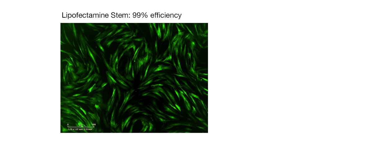Lipofectamine 干细胞转染试剂 | Thermo Fisher Scientific - CN