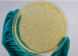 Genotypes and Genetic Markers of E. coli Competent Cells | Thermo ...