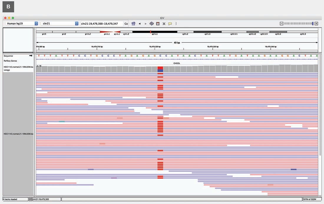 NGS Data Analysis for Illumina Platform—Overview and Workflow | Thermo ...