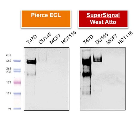 Detecting Low Abundance Proteins in Western Blotting | Thermo Fisher ...
