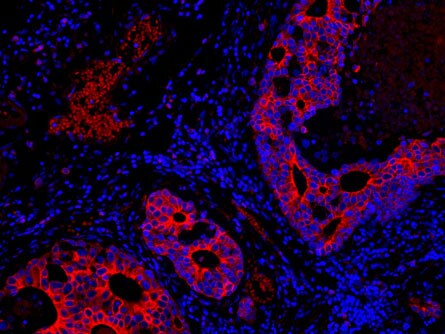 免疫荧光IHC检测方法-赛默飞 | Thermo Fisher Scientific - CN