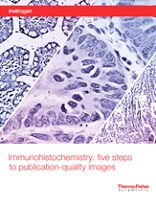 Overview of Immunohistochemistry | Thermo Fisher Scientific - CN