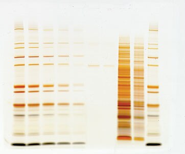 Protein Gel Staining Methods | Thermo Fisher Scientific - CN