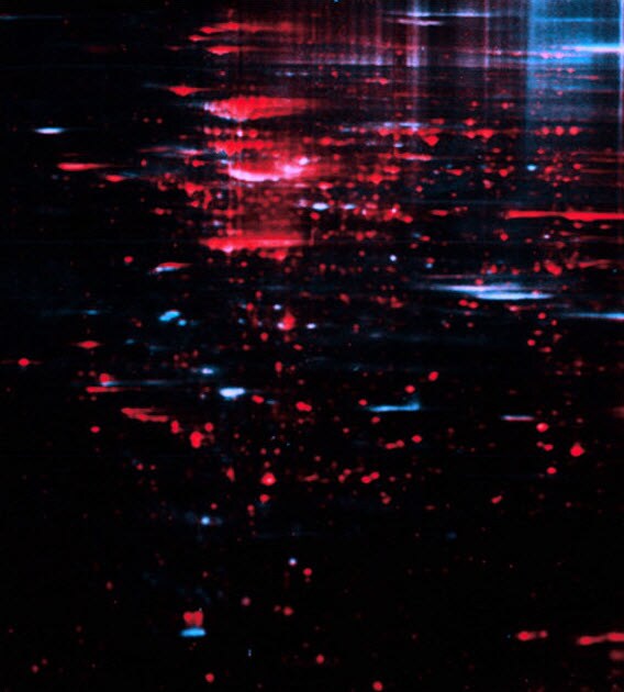 Protein Gel Staining Methods | Thermo Fisher Scientific - CN