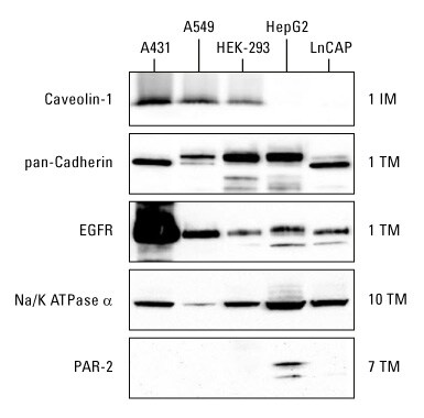 Efficient Mammalian Membrane Protein Extraction | Thermo Fisher ...