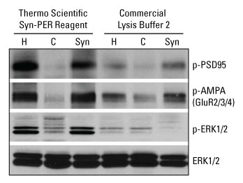 Isolate Functional Synaptosomes | Thermo Fisher Scientific - CN