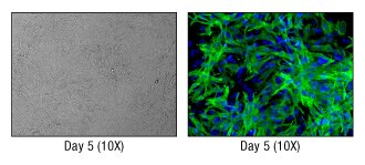 One-Hour Procedure to Isolate Primary Cardiomyocytes from Neonatal ...
