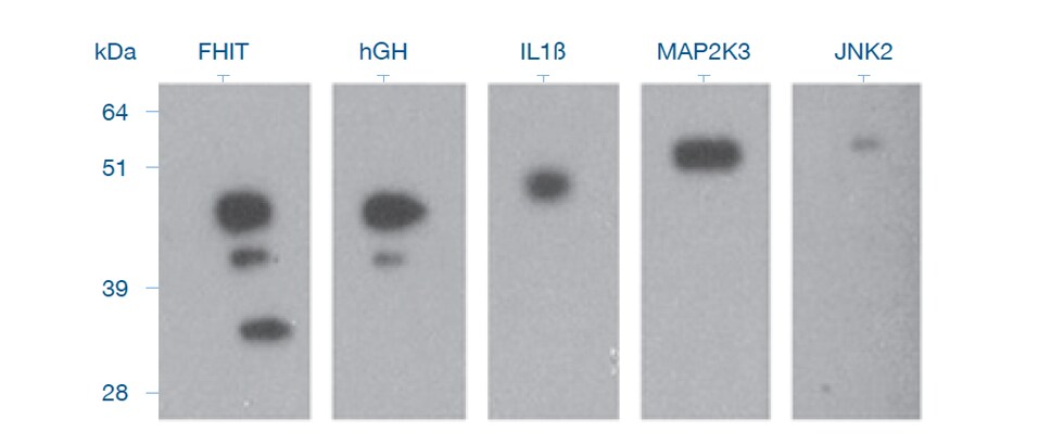 Insect Cell–Based Protein Expression — Protein Expression Handbook ...