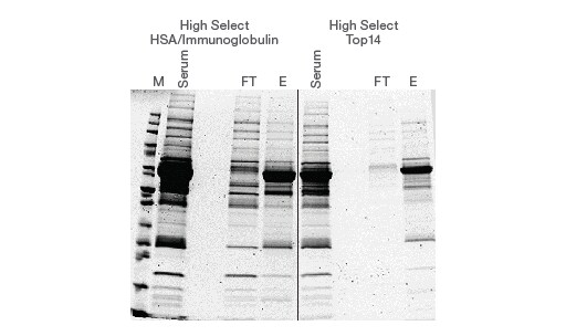 Abundant Protein Depletion for Mass Spectrometry | Thermo Fisher Scientific - CN