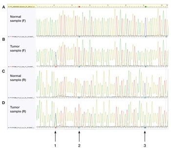 Sanger Sequencing and Fragment Analysis by CE | Thermo Fisher ...