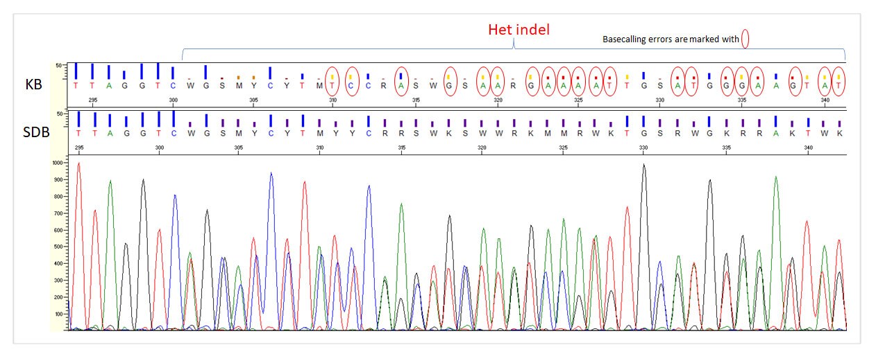 Smart Deep™ 碱基识别软件 | Thermo Fisher Scientific - CN