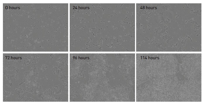Single-Cell Passaging with Essential 8 Medium | Thermo Fisher ...
