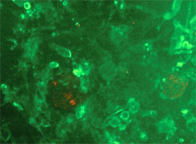 干细胞培养-iPSC干细胞鉴定-赛默飞| Thermo Fisher Scientific - CN | Thermo Fisher ...