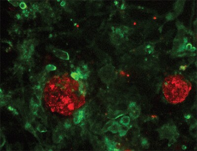 干细胞培养-iPSC干细胞鉴定-赛默飞| Thermo Fisher Scientific - CN | Thermo Fisher ...