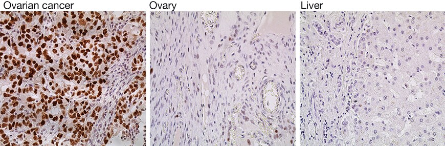 Detection of Tumor Markers—IHC Solutions | Thermo Fisher Scientific - CN