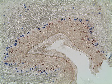 Click-iT EdU and Click-iT TUNEL Colorimetric Assays for ...