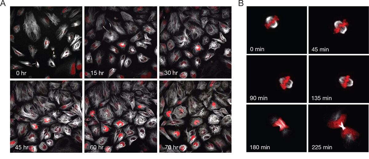 Visualize Microtubule Dynamics in Live Cells | Thermo Fisher Scientific ...