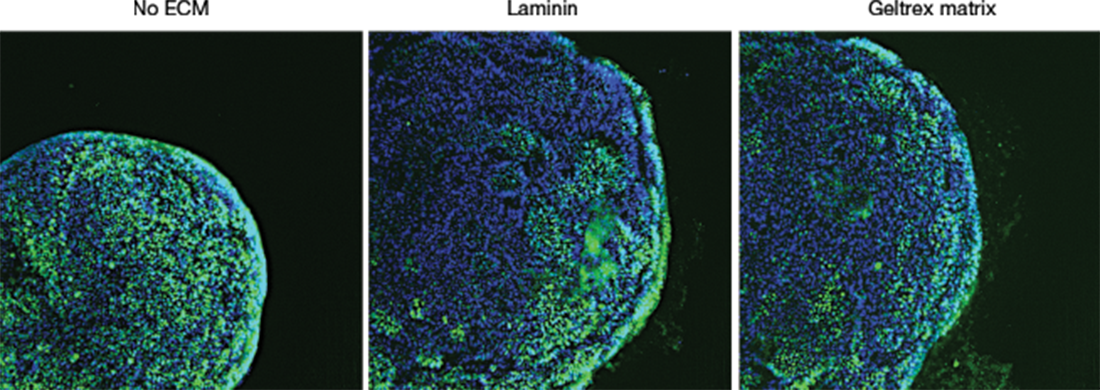 3D Midbrain Organoid Model Development | Thermo Fisher Scientific - CN