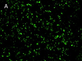 Transfecting Plasmid DNA Into A549 Cells Using Lipofectamine 3000 ...