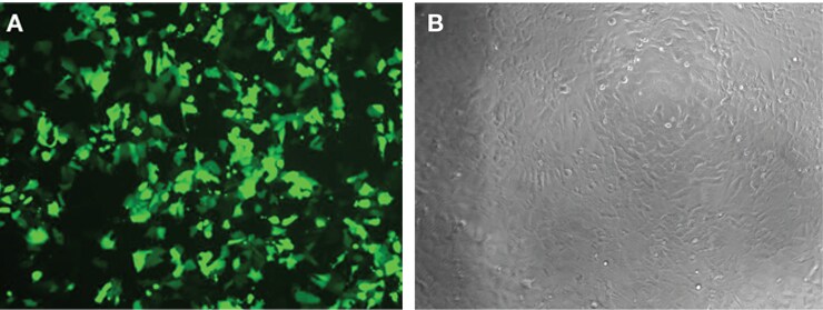 Transfecting Plasmid DNA Into Hep 3B2.1-7 Cells Using Lipofectamine ...