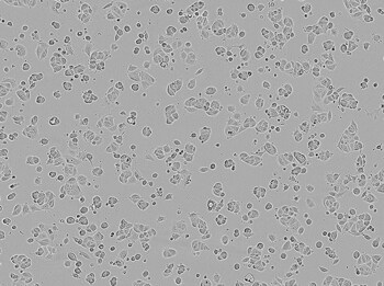 Transfecting Plasmid DNA Into MCF7 Cells Using Lipofectamine 3000 ...