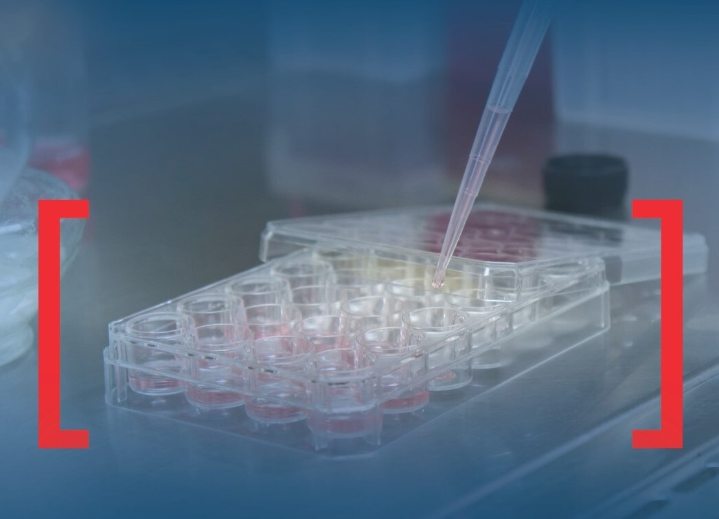 Guidelines for Plasmid DNA Transfection | Thermo Fisher Scientific - CN