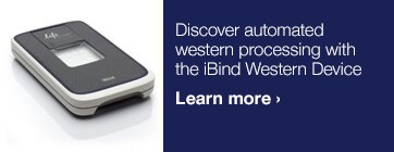 Zeba Spin Desalting Columns | Thermo Fisher Scientific - CN