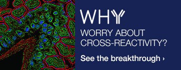 Luciferase Assays | Thermo Fisher Scientific - CN